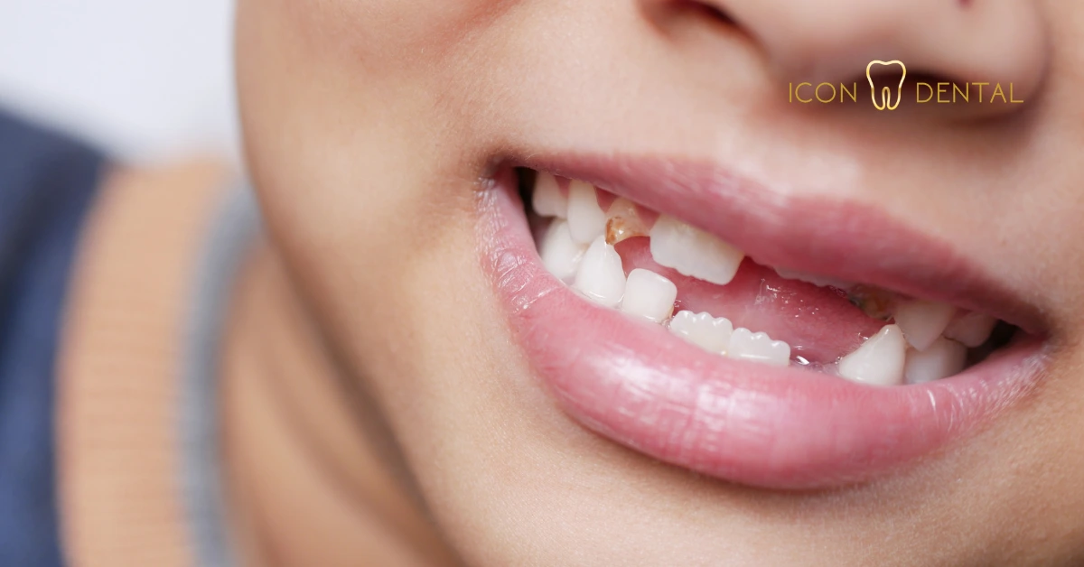 Implant Tooth Cost in Malaysia: Affordable Solutions for Your Smile